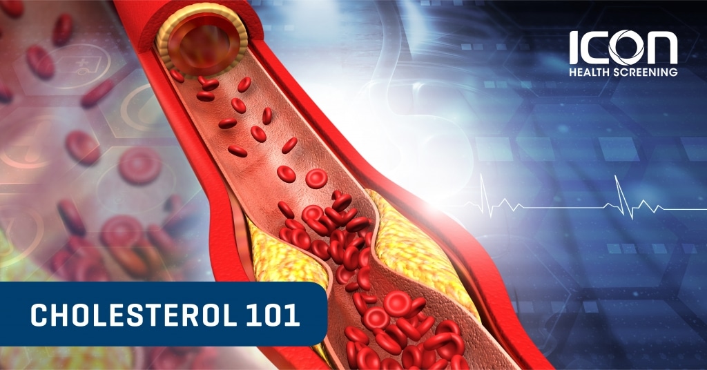 Managing your high cholesterol — Icon Health Screening